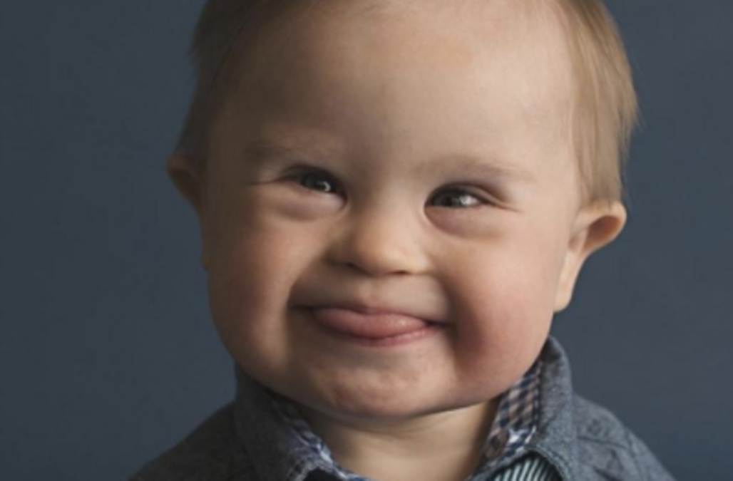 Photos Of Babies With Down Syndrome at Emery Espinosa blog