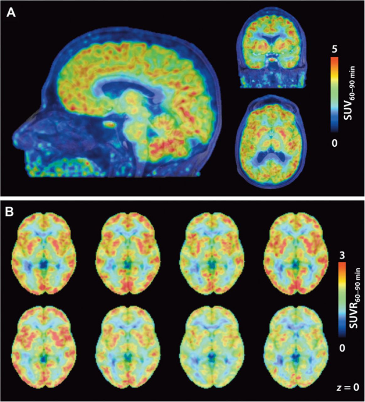 Scientists see gene activation in human brain for the first time