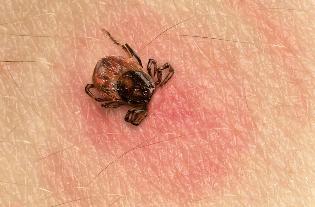 Here’s how you can figure out what these 9 common bug bites are this ...