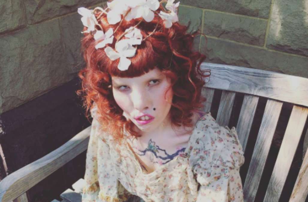 Gorgeous model with 'Cat Eye Syndrome' breaks barriers in the fashion ...
