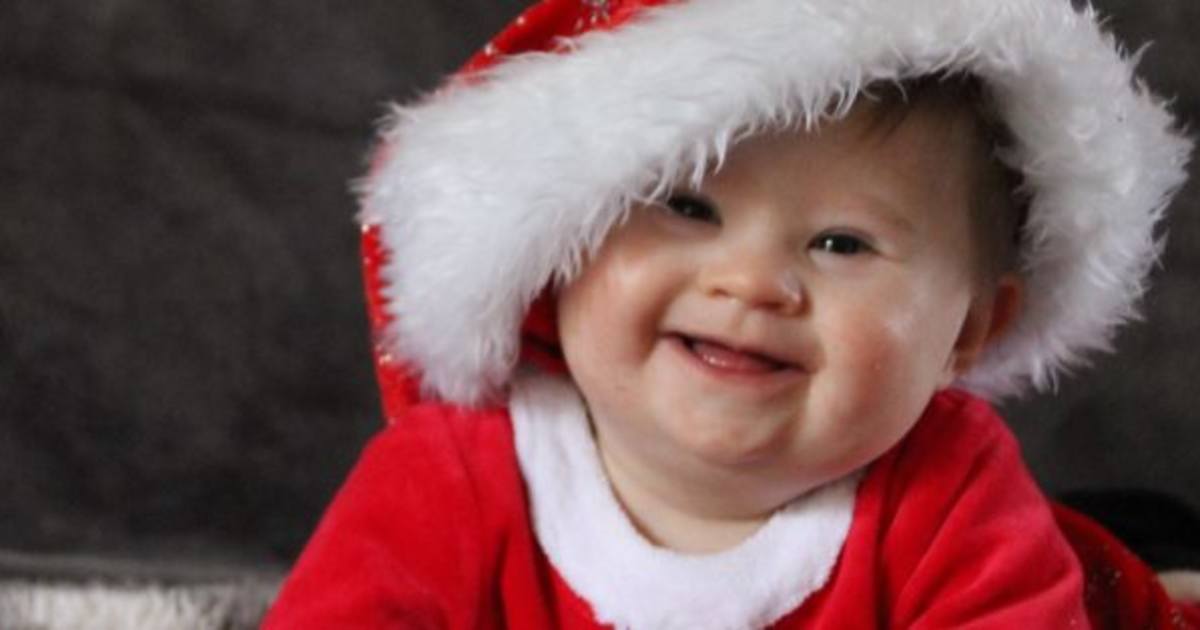 Porteur de trisomie 21, ce bébé arrive premier d'un concours de photo